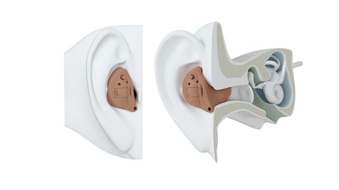Completely in Canal (Invisible) - Custom Hearing Aids | ReSound