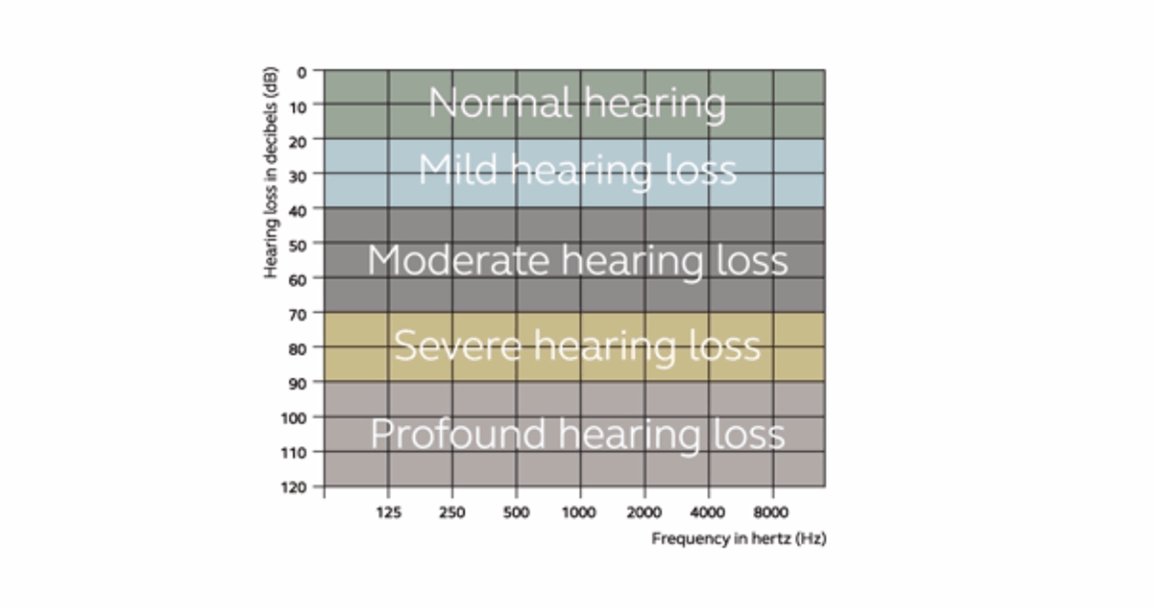 Hearing Loss Chart Decibels Sound Check Data Highlights | Sound Check