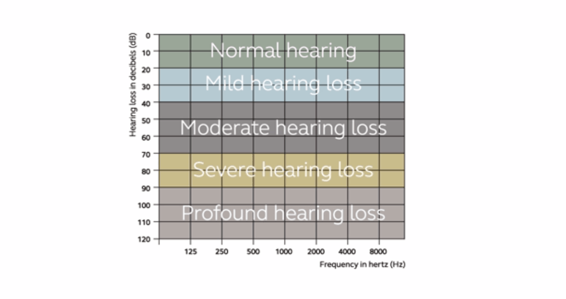 Understanding hearing loss | ReSound