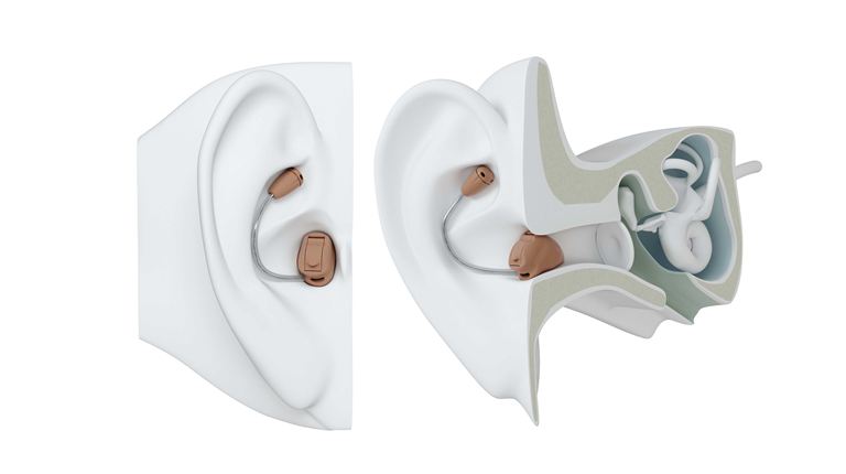 Learn about custom hearing aids and why they could be for you | ReSound